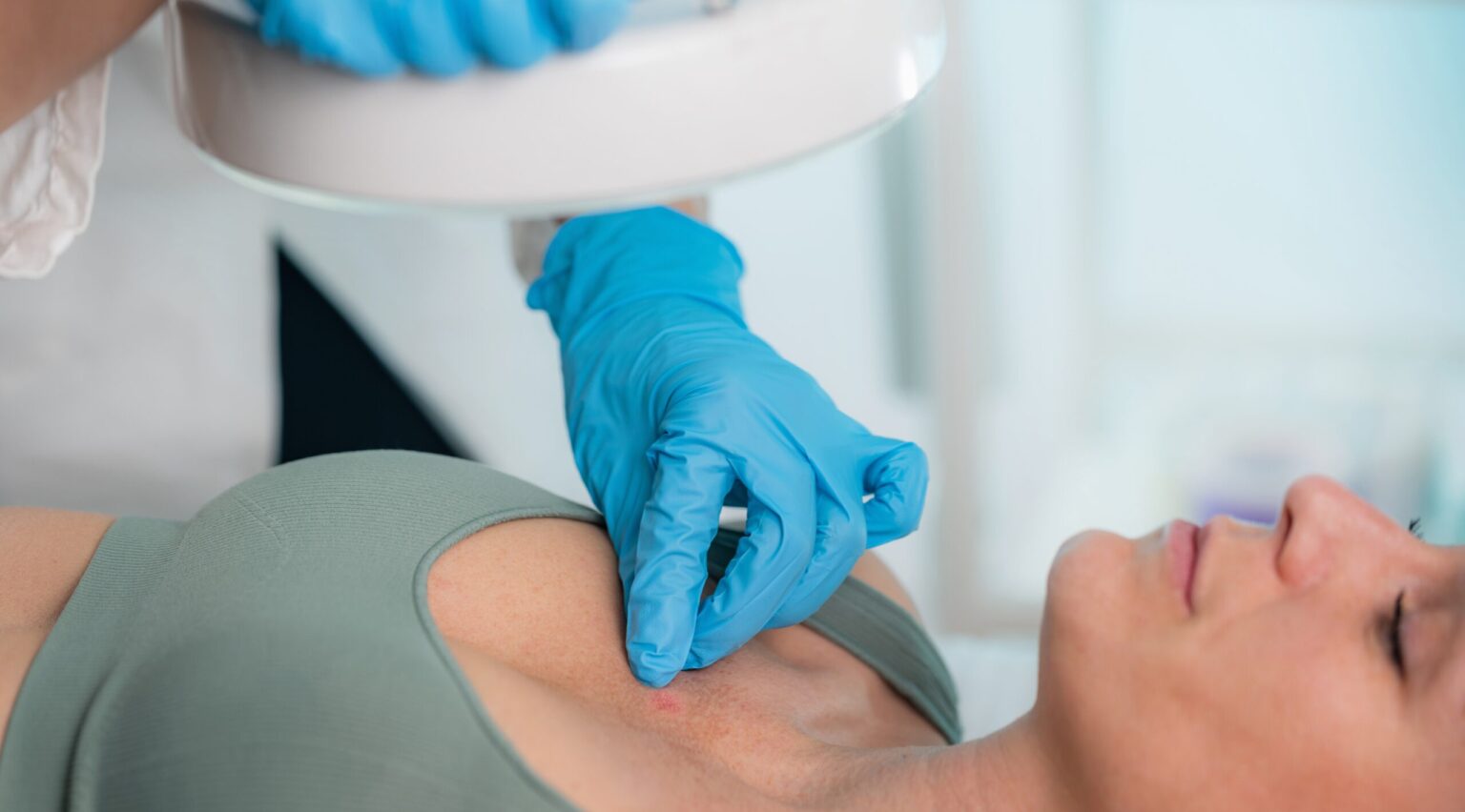 Actinic Keratosis: Causes, Diagnosis, and Treatment